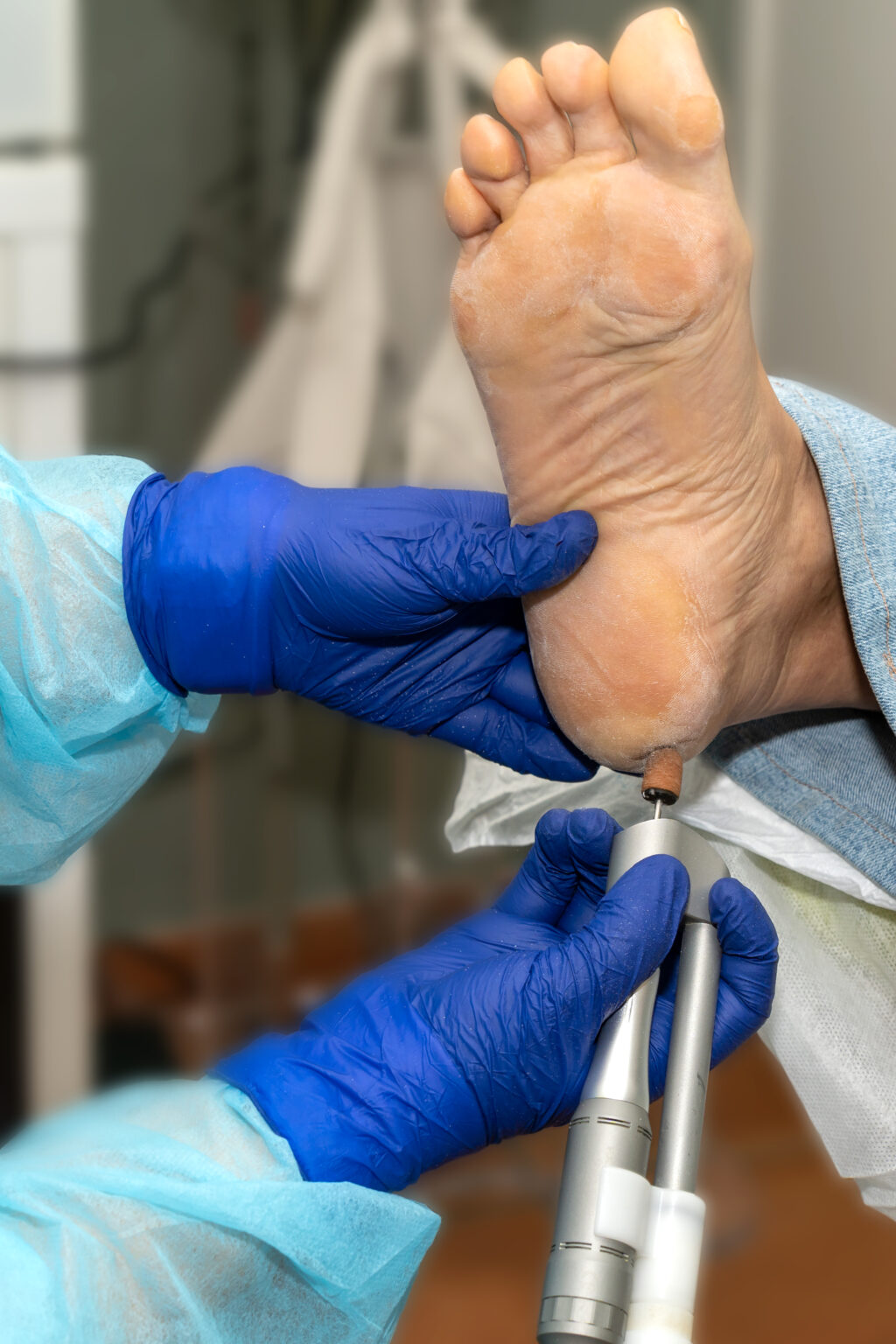 Foot Care Treatment in Bangalore | Ananya Hospitals